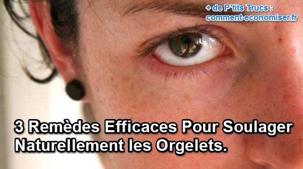3 Remèdes Efficaces Pour Soulager Naturellement les Orgelets.